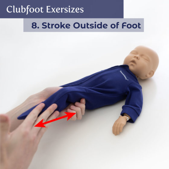 Clubfoot Exercises - StandInBaby®